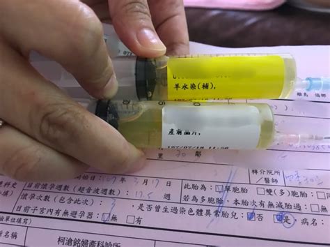 【孕】二寶孕中期紀錄 羊膜穿刺and高層次超音波 914生活演繹