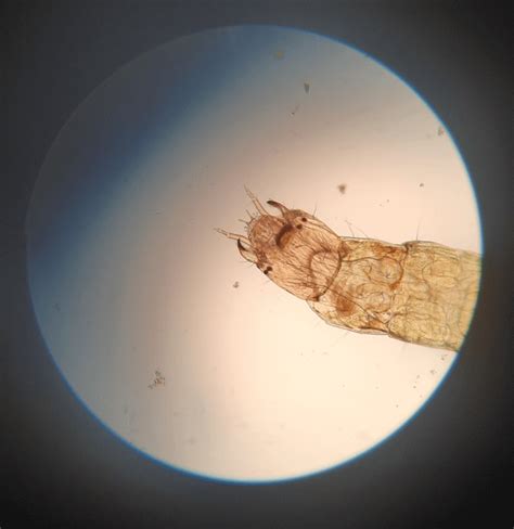 🔥 What I Found In Pond Water Under A Microscope Rnatureisfuckinglit
