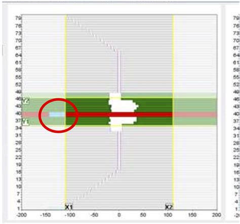 A Snapshot Of An Imrt Step‐and‐shoot Delivery That Captures Number 40 Download Scientific