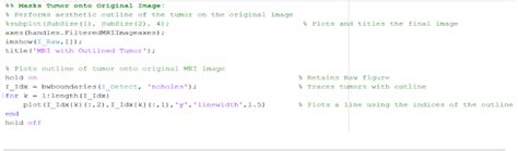 Brain Tumor Mri Detection Using Matlab 6 Steps Instructables