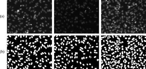 Figure 1 From Nuclei Segmentation Using Cascaded Bilateral Attention U