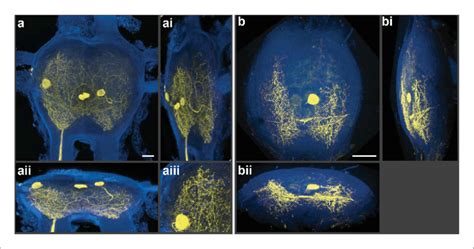 Silver Impregnated Motoneurons Imaged With The New Protocol And The Download Scientific Diagram
