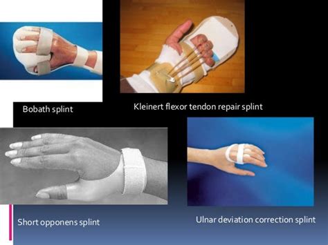 Upper Limb Orthosis