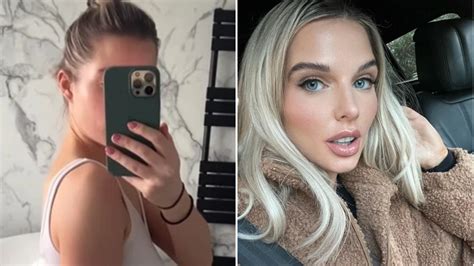 Helen Flanagan Shows Off Boob Job After Three Years Of Breastfeeding
