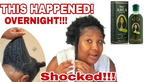 Shocking Results I Left Amla Oil On My 4b4c Hair Overnight And This
