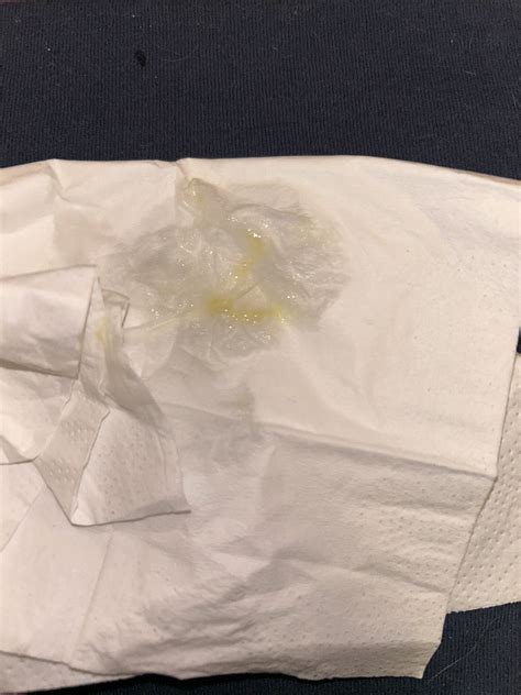 Mucus Nasal Jaune Fluo