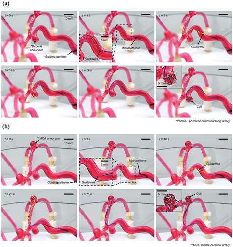Simulation Of Endovascular Intervention Under Optical Images In A Download Scientific Diagram