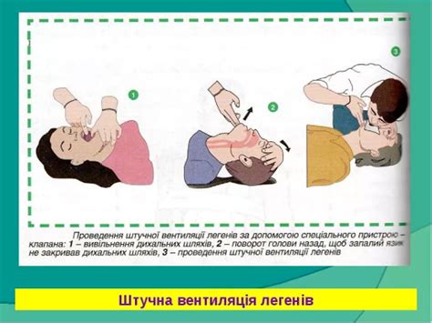ЗАХИСТ ВiТЧИЗНИ ОСНОВИ МЕДИЧНИХ ЗНАНЬ Додатковий матеріал до теми Штучне дихання його