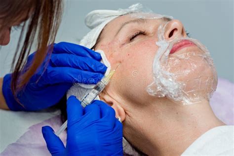 Woman Receiving Botox Injection Stock Image Image Of Rejuvenation