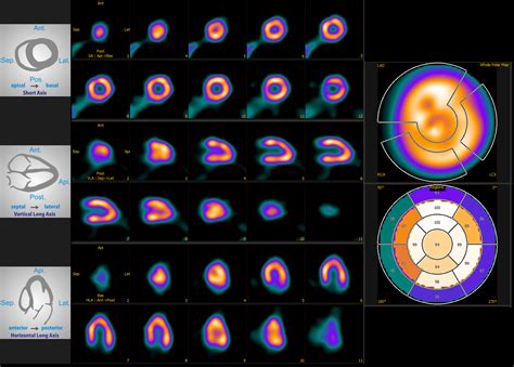 Mibitop 1 Mg Kit Institute Of Isotopes