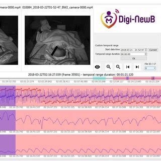 Screenshot Of Visiannot Software Illustrating A Sigh In A Newborn At