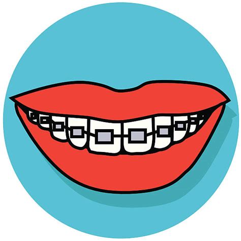 Braces Clip Art Vector Images And Illustrations Istock