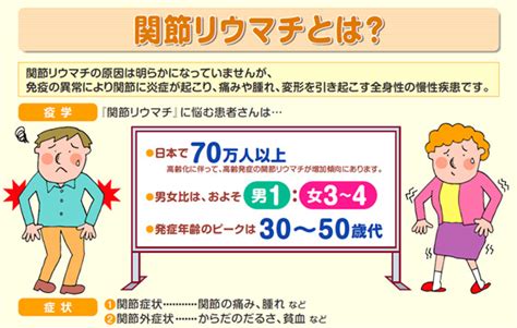 関節リウマチ 横浜市都筑区の内科リウマチ科アレルギー科糖尿病内分泌科都筑あずま内科リウマチ科 都筑あずま内科リウマチ科