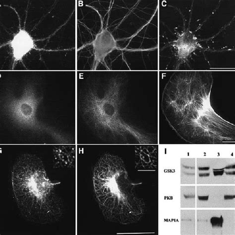 Kinesin Heavy And Light Chain Isoforms Show Different Phosphorylation Download Scientific