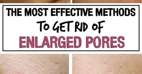 How To Minimize Pores In Different Ways At Home