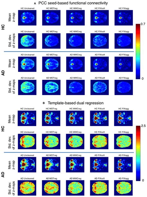 Within Group Consistency Of Pcc Seed Based Fc A And The Dmn Component