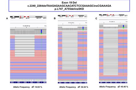 Next Generation Sequencing Ngs Performed On The Primary Lung Tumor At