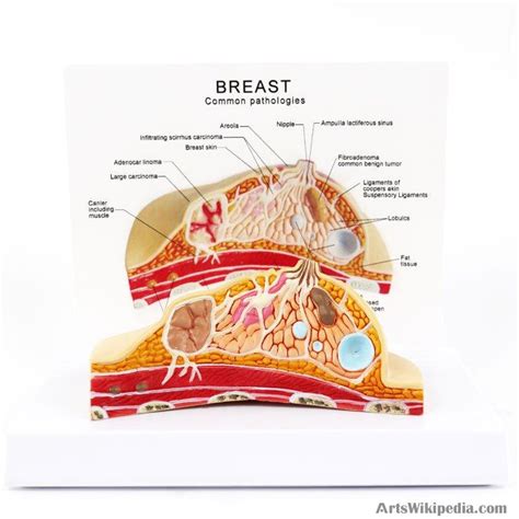 Real Human Size Median Section Model Of Human Female Breast Pathology
