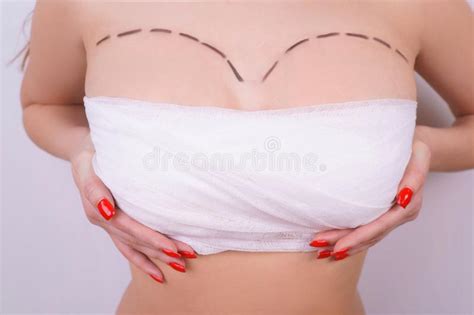 Bandaged Breasts With Markings After Plastic Surgery Operation Stock