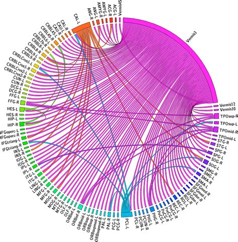 The Significant CorrTF Connections That Characterize The EMCI