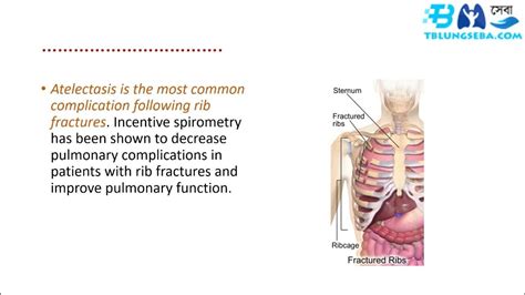 Role Of Incentive Spirometer In Chest Physiotherapy Learning