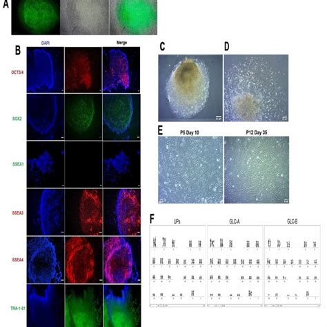 Ipscs Characterization By If And Guided Differentiation Of Ipscs To Download Scientific Diagram