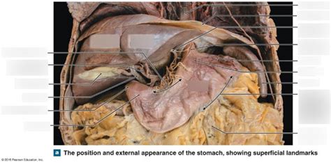 Gi Anatomy 13 Diagram Quizlet