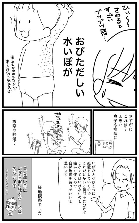 《子供の感染症あるある8》夏に気を付けたい「水いぼ」ってどんな病気？ 医師が作る医療情報メディア【medicommi】