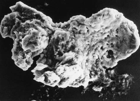 Scanning Electron Photomicrographs Of Filtered Particle 15 Kv