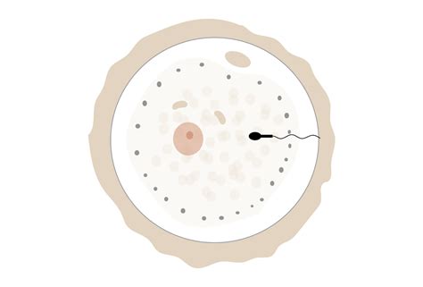 Treatment Option In Vitro Fertilization Ivf With Donor Sperm — Arbor