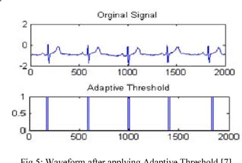 Figure From Comparative Study Of ECG Feature Extraction Methods Semantic Scholar