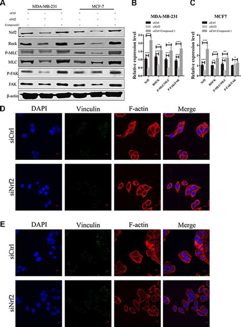 Nrf2 Promotes Breast Cancer Cell Proliferation And Metastasis By