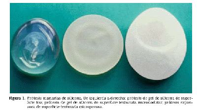 Soley Laser Tratamientos Médico Estéticos MAMOPLASTIA O AUMENTO DE PECHO