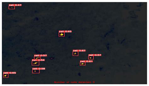 diagnostics free full text yolov5 fpn a robust framework for multi