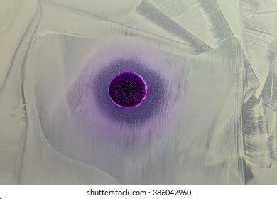 Disk Diffusion Test Stock Photo 386047960 Shutterstock