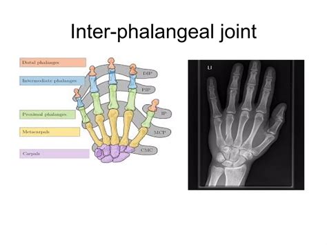 Joints Of Upper Limb Ppt