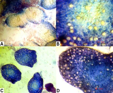 Azure B Eosin Y Staining Demonstrated Before The Exposition Of Ozonized