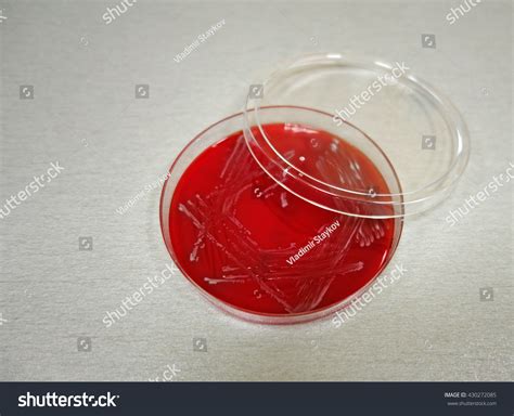 Enterococcus Spp Gram Staining Of Enterococcus