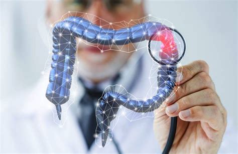 Tratamiento a Pólipos del colon y recto ofrecido por él Dr. Luis Alberto Espino Urbina ...