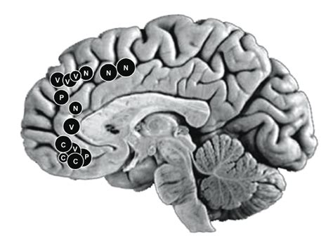 Regions Of The Medial Prefrontal Cortex Identified With Fmri Showing