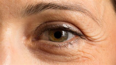 The Truth About Crows Feet And How You Can Avoid Them The List