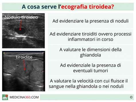 Ecografia Tiroidea A Cosa Serve Come Si Fa Quanto Costa