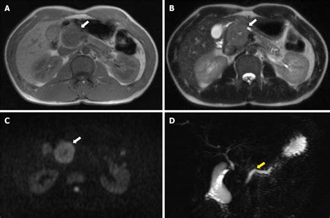 Magnetic Resonance Imaging And Magnetic Resonance Download Scientific Diagram