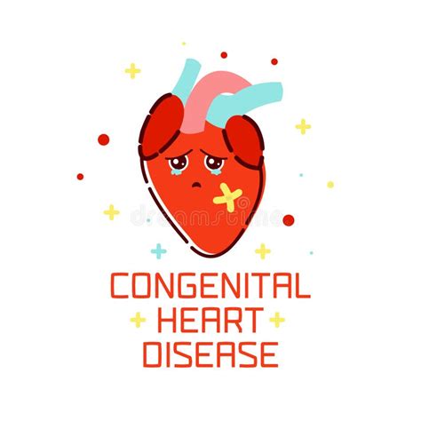Congenital Heart Disease Tetralogy Of Fallot Stock Vector