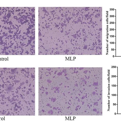 Mlp Inhibited The Cell Migration And Invasion Of Breast Cancer Cells