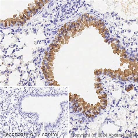 Avidinbiotin Blocking Kit 15 Ml Ab64212 Abcam