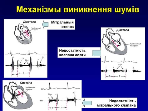 Аускульція серця органічні та функціональні серцеві шуми презентация
