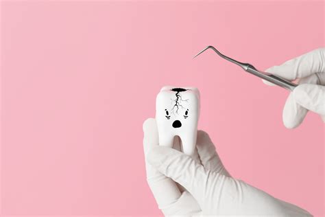 Cracked Teeth Causes And Treatments