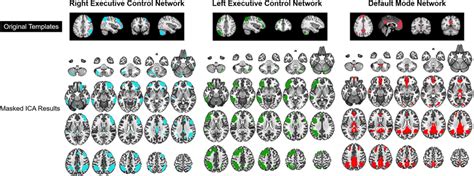 Independent Component Analysis Ica Was Conducted On Simple Motor Task Download Scientific