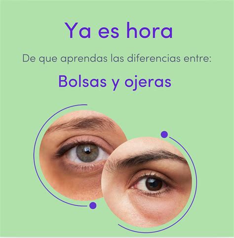 Sabes Distinguir Entre Ojeras Y Bolsas De Los Ojos Aunque A Menudo